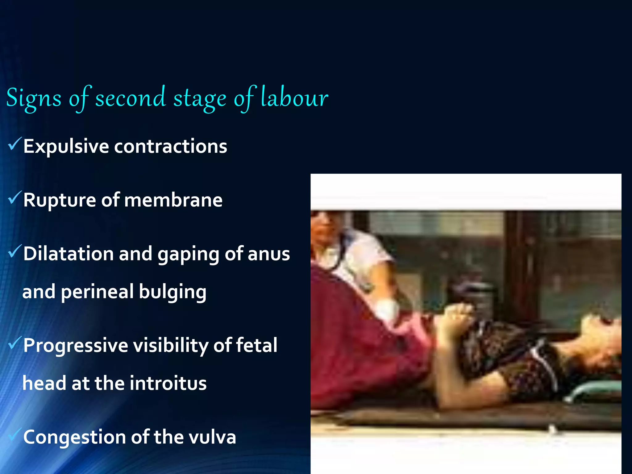 Physiology and Mangement of 2nd stage labour | PPTX