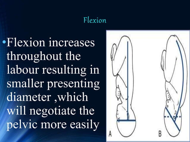 Physiology and Mangement of 2nd stage labour | PPTX | Pregnancy ...