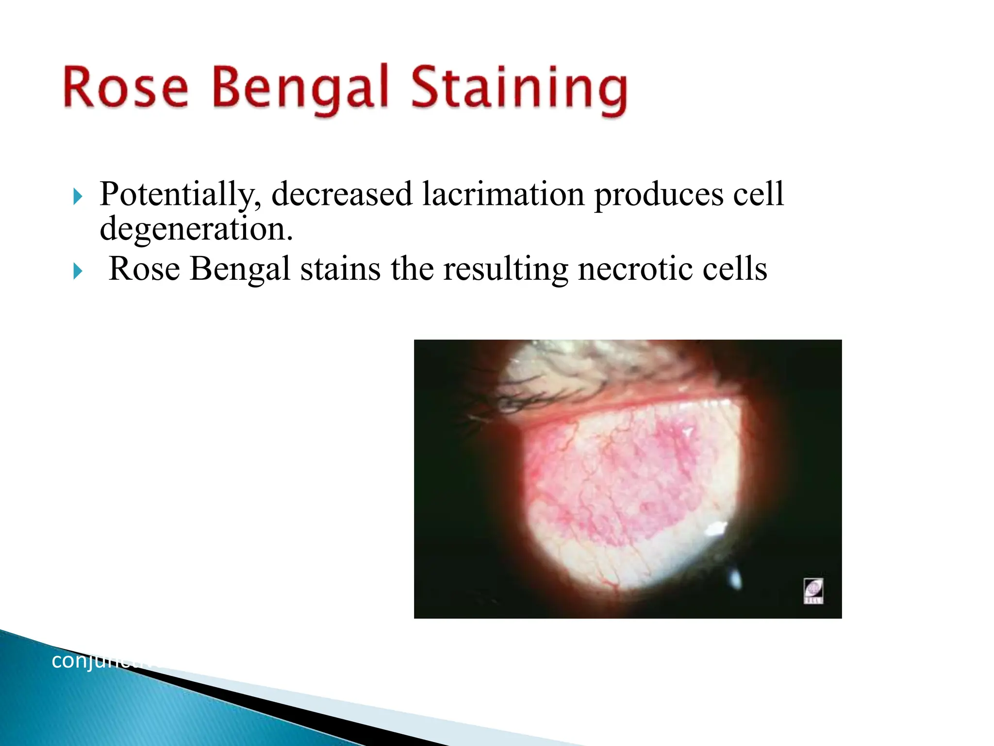 3 physiology (Ant.segment) .ppt