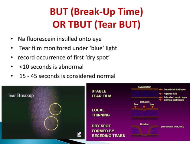 3 physiology (Ant.segment) .ppt