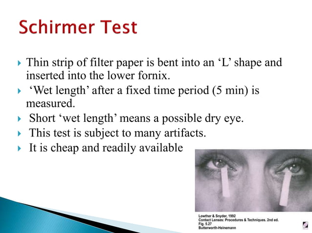 3 physiology (Ant.segment) .ppt