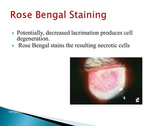 3 physiology (Ant.segment) .ppt