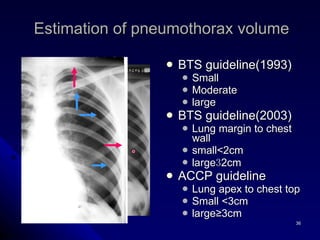 3 pneumothorax | PPT