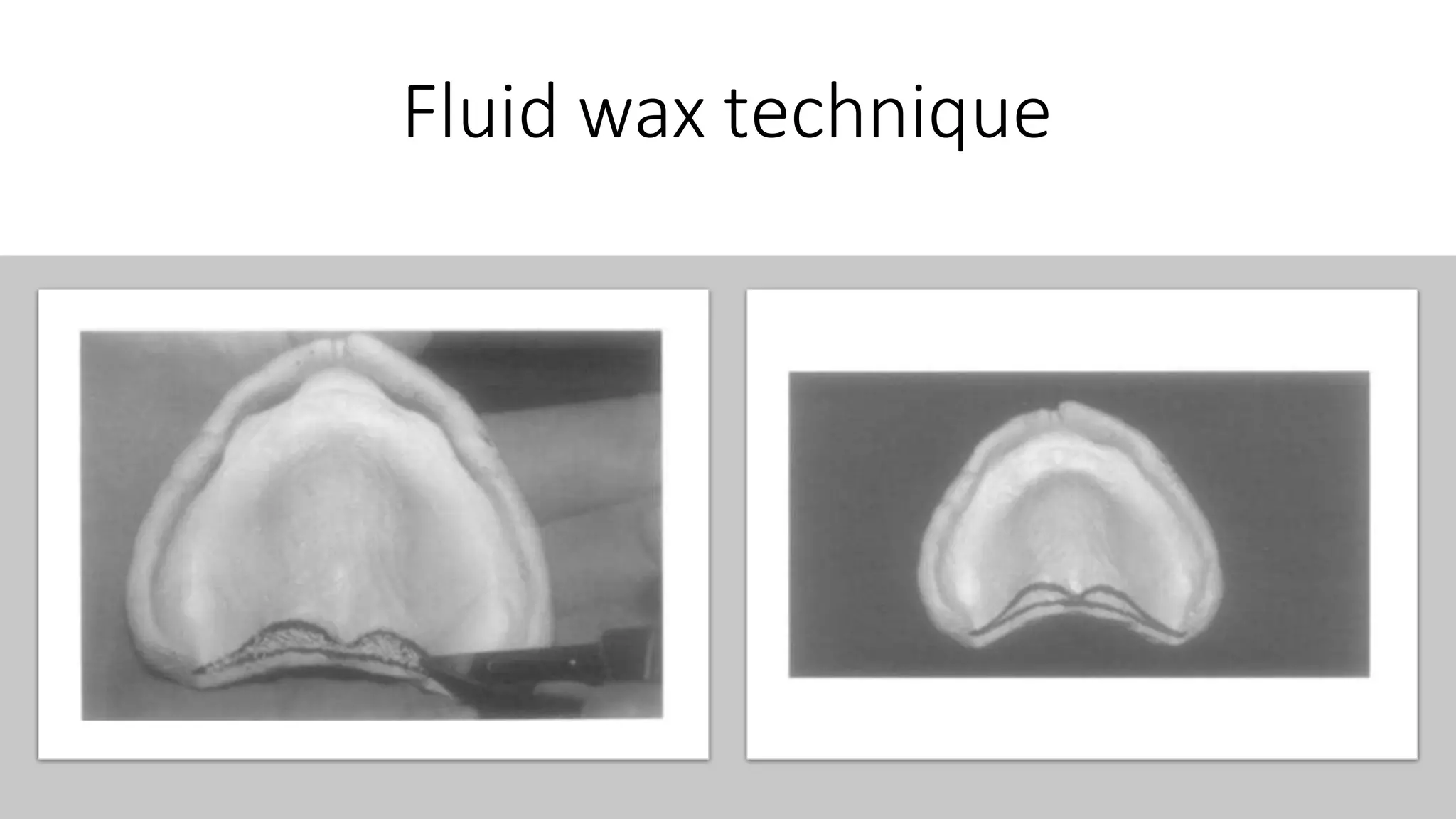 3 Posterior palatal seal area lecture.pptx