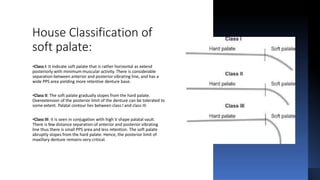 3 Posterior palatal seal area lecture.pptx