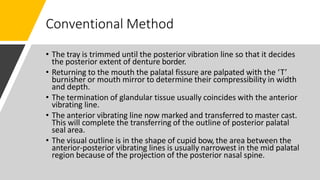 3 Posterior palatal seal area lecture.pptx