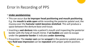 3 Posterior palatal seal area lecture.pptx