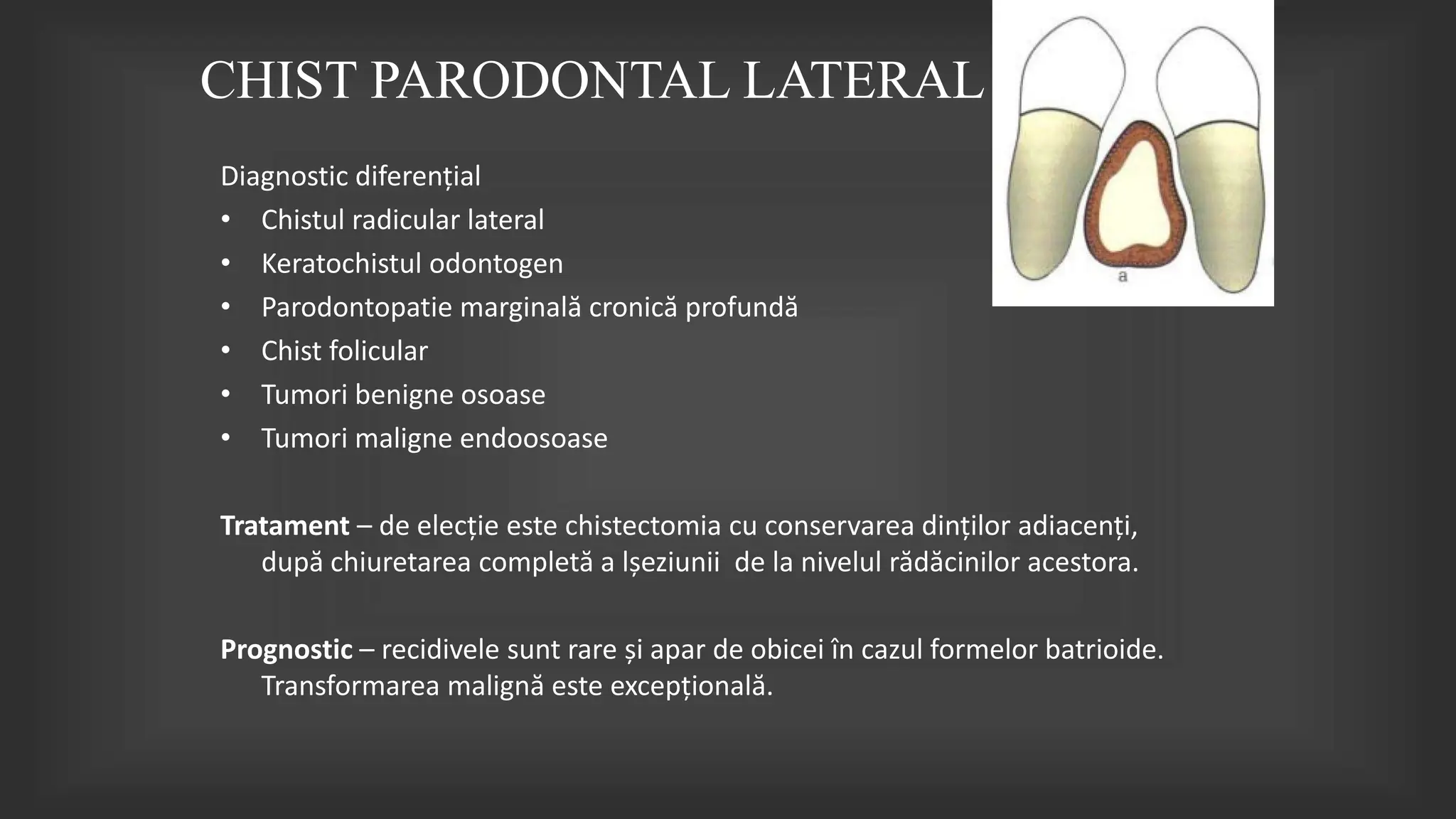 3 Prelegere Chisturile odontogene....ppt