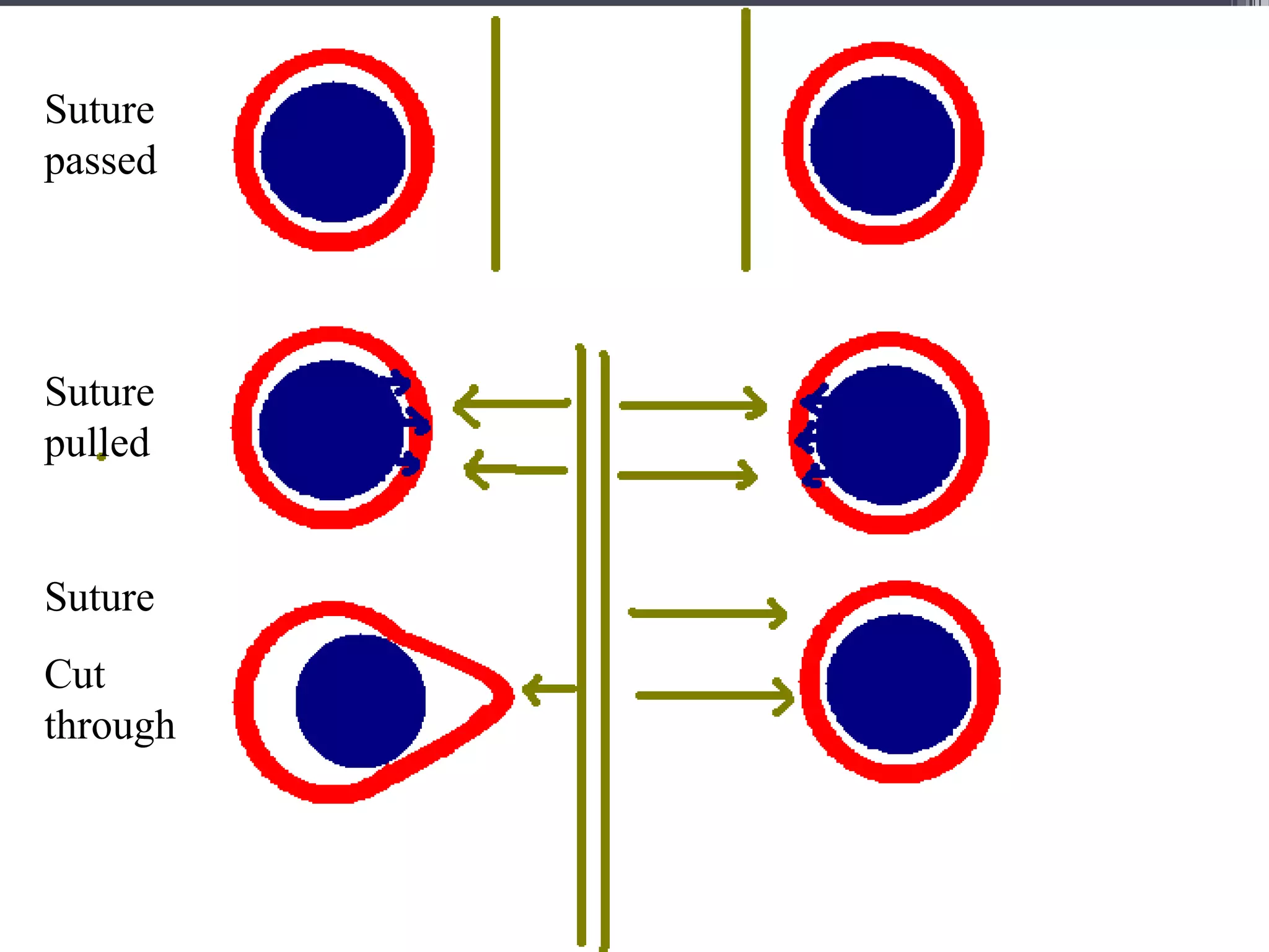 3 print version nurses basics of vascular surgery Open heart surgery | PPT