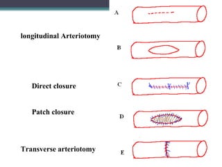 3 print version nurses basics of vascular surgery Open heart surgery | PPT