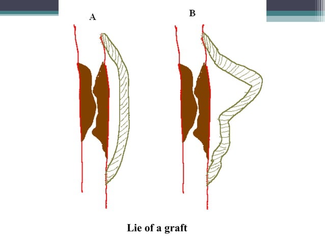 3 print version nurses basics of vascular surgery Open heart surgery | PPT