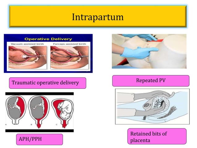Puerperal Infection | PPTX | Pregnancy | Reproductive Health