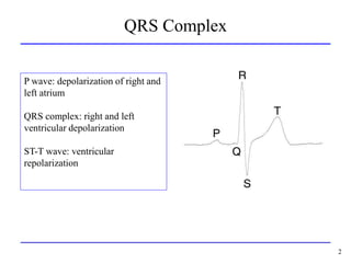 QRS detection is important in all kinds of ECG signal processing | PPT