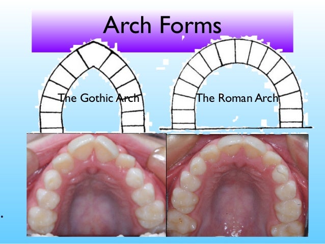3 rcio spreecast malocclusion