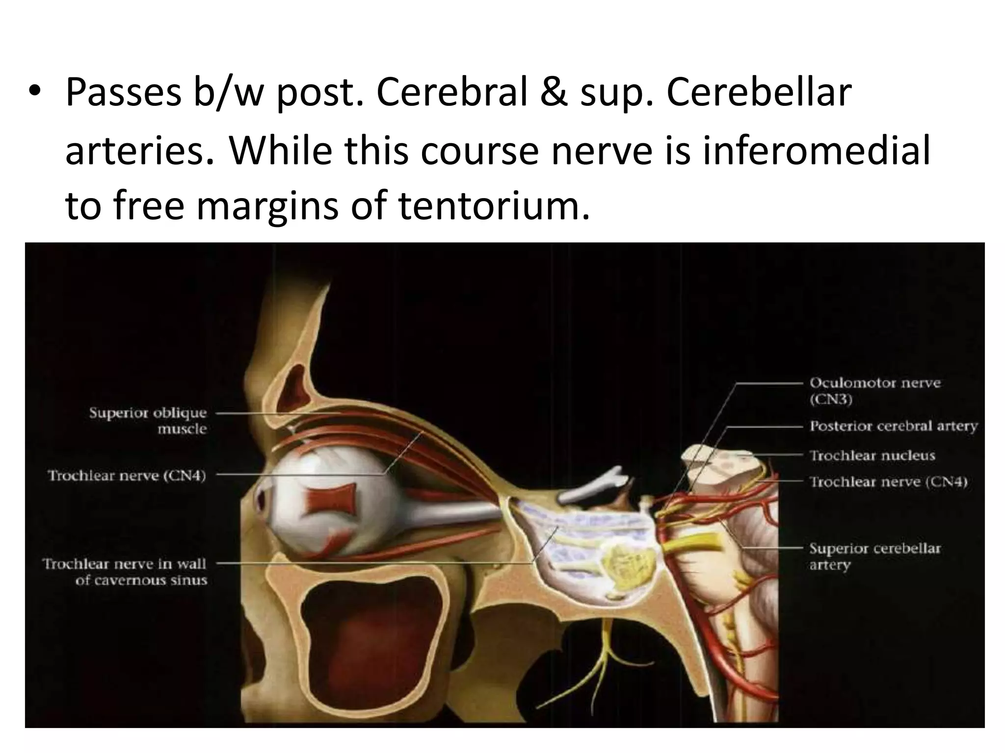 3rd, 4th and 6th cranial nerve | PPTX