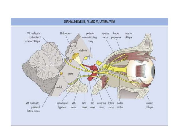 3rd, 4th and 6th cranial nerve | PPTX | Brain and Nervous System ...