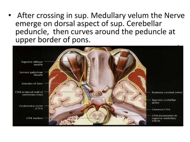 3rd, 4th and 6th cranial nerve | PPTX | Brain and Nervous System ...
