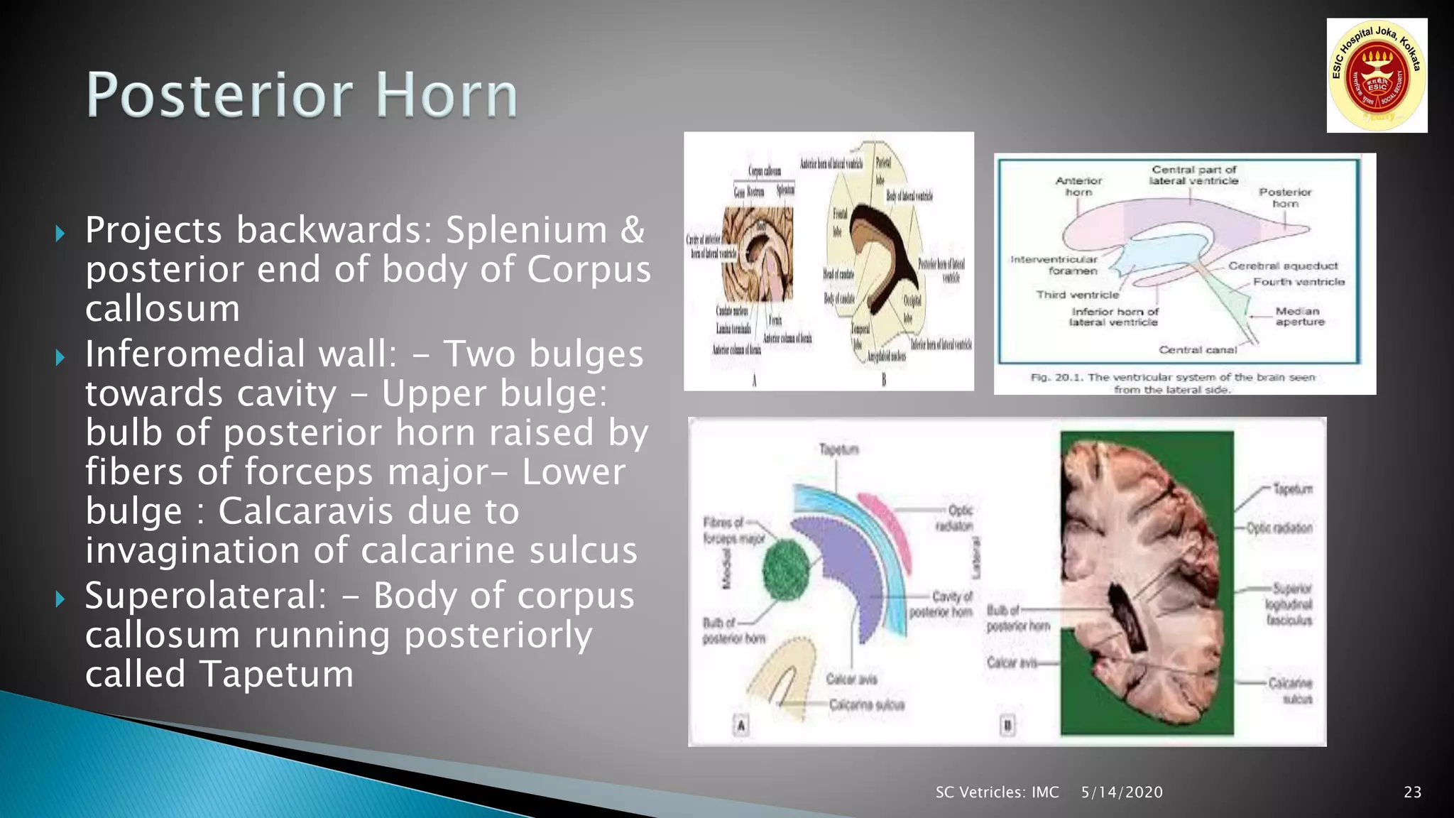 3rd and lateral ventricles pdf | PDF