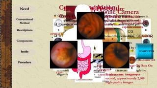 PILL CAMERA | PPT