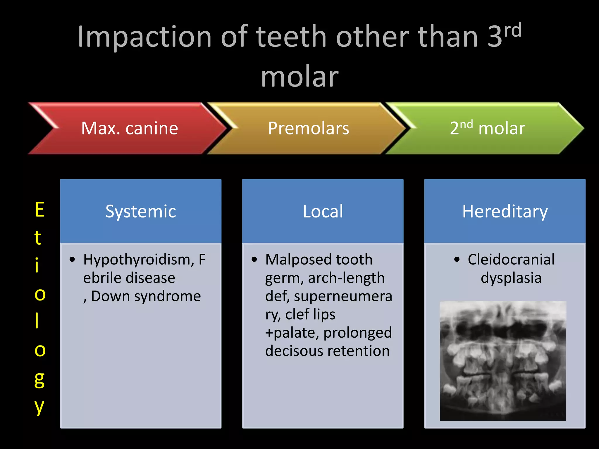 Impacted Mandibular 3rd Molar & other teeth than 3rd molar | PPTX