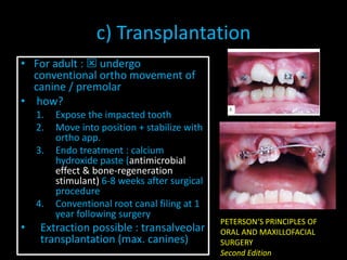Impacted Mandibular 3rd Molar & other teeth than 3rd molar | PPTX