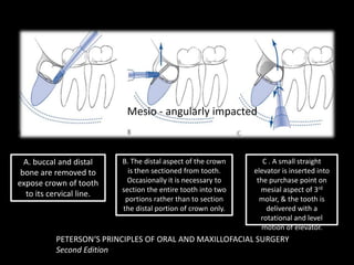 Impacted Mandibular 3rd Molar & other teeth than 3rd molar | PPTX