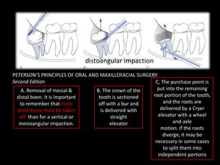 Impacted Mandibular 3rd Molar & other teeth than 3rd molar | PPTX