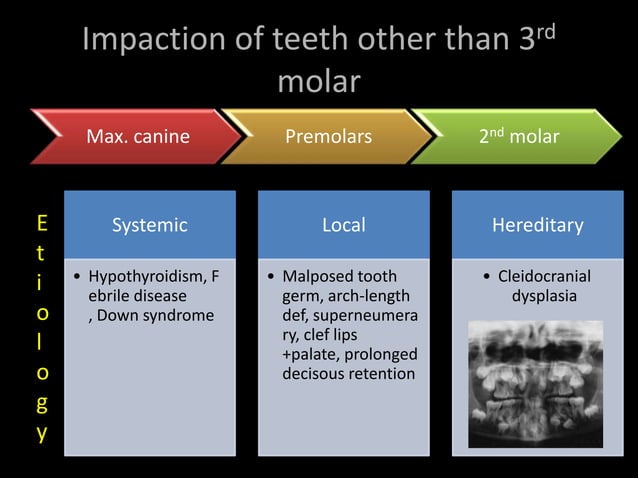 Impacted Mandibular 3rd Molar & other teeth than 3rd molar | PPTX ...