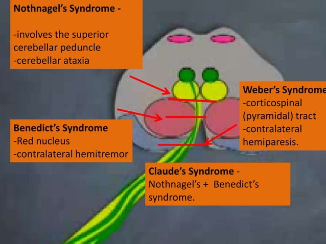 3rd cranial nerve | PPTX | Brain and Nervous System Disorders ...