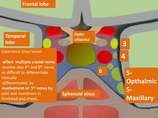 3rd cranial nerve | PPTX