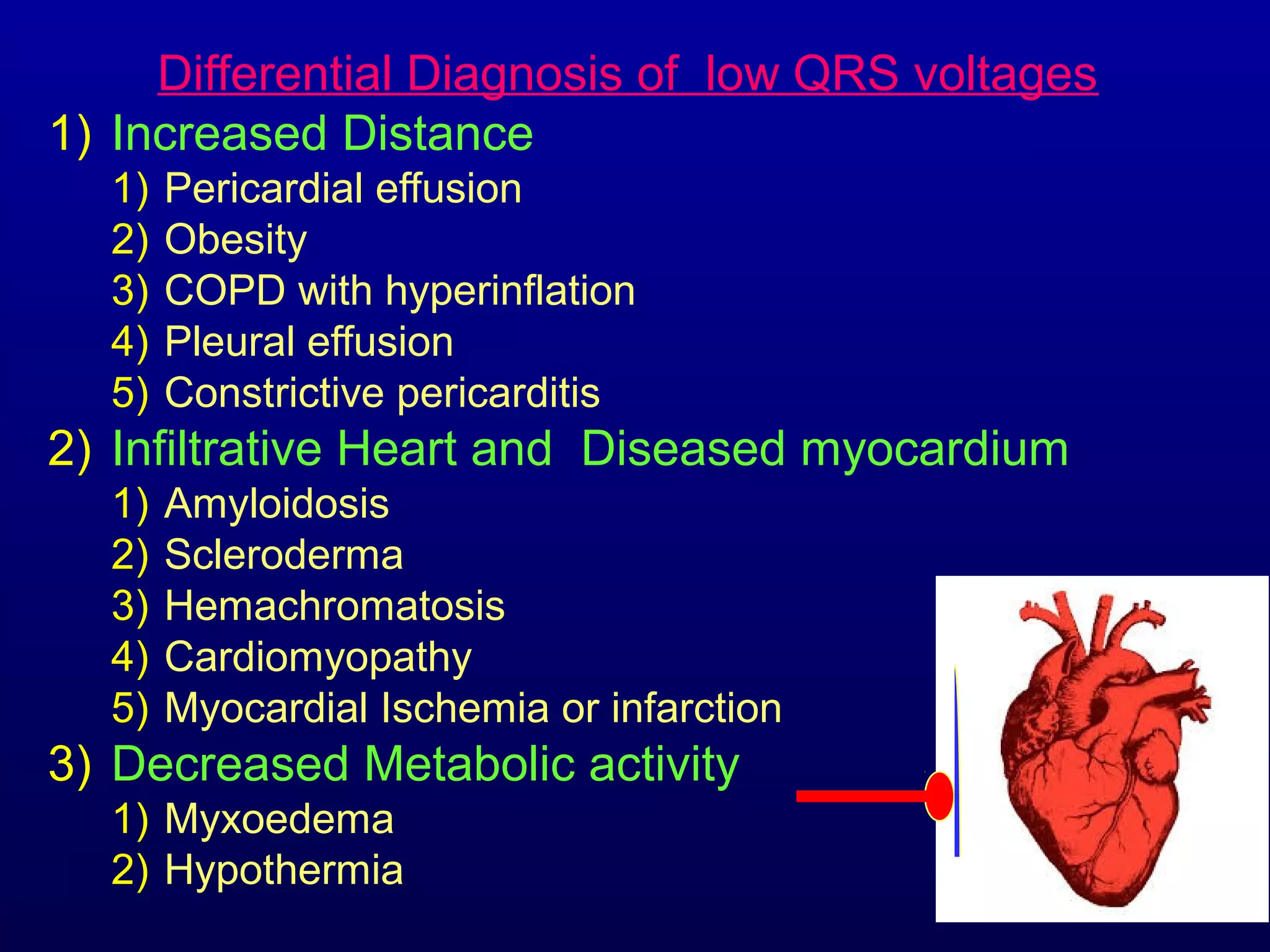 3rd part ECG Basics QRS complex Dr Salah Mabrouk Khallaf | PPT