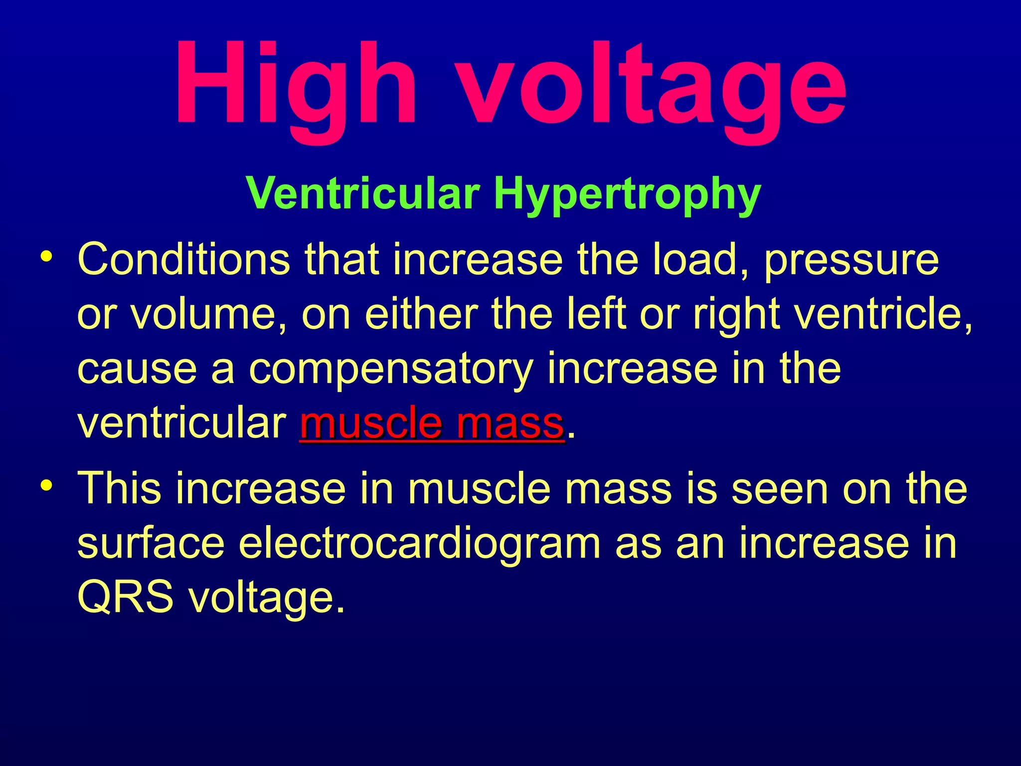 3rd part ECG Basics QRS complex Dr Salah Mabrouk Khallaf | PPT