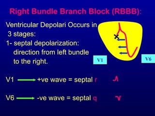 3rd part ECG Basics QRS complex Dr Salah Mabrouk Khallaf | PPT