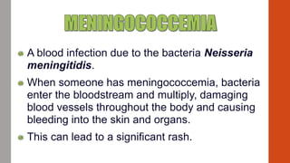 Emerging and Re-emerging Diseases | PPTX