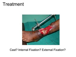 3rd Quarter Notes | PPT