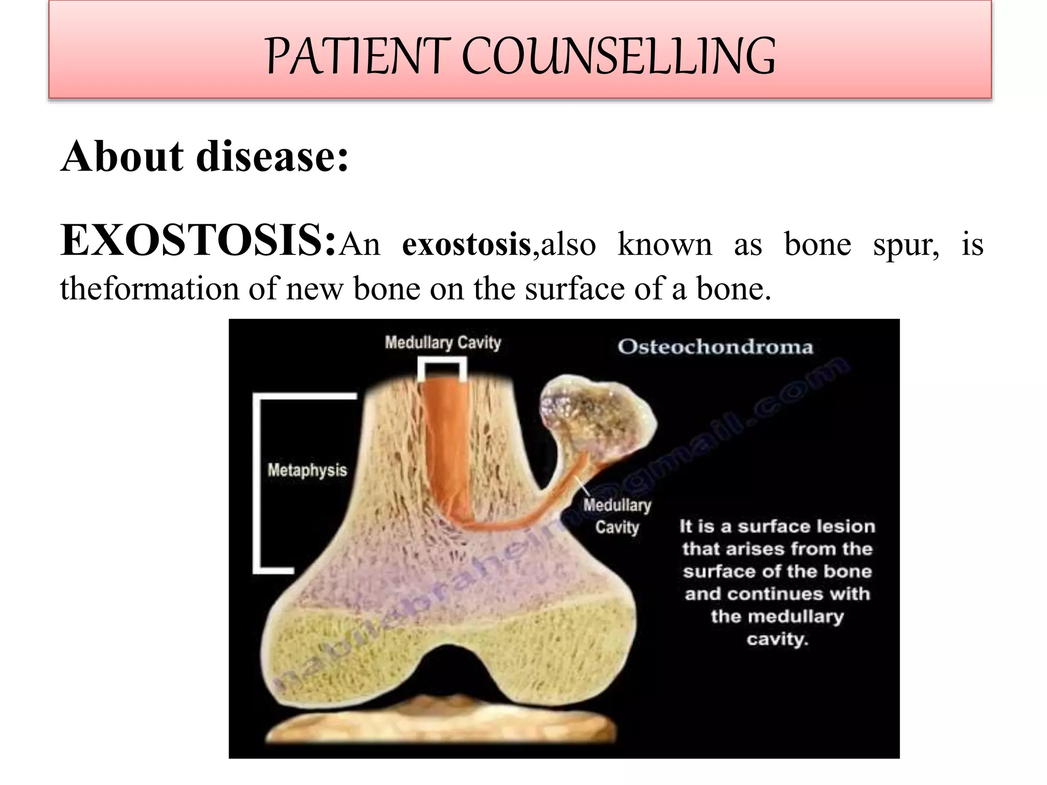 Left Femur And Tibia Exostosis Ppt