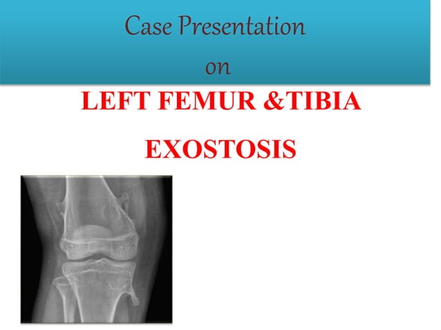 Left Femur And Tibia Exostosis Ppt
