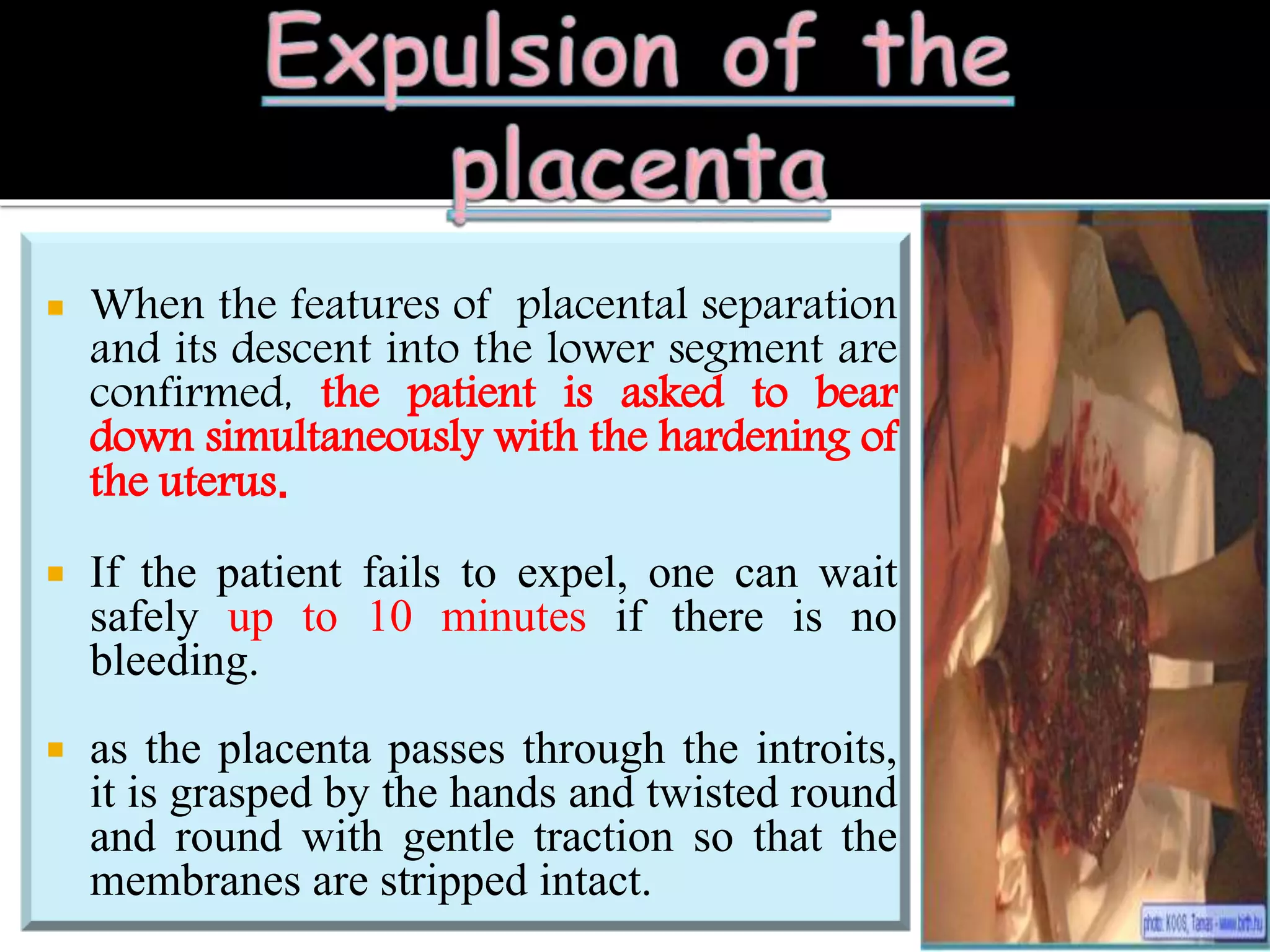 3rd stage OF LABOUR | PPTX