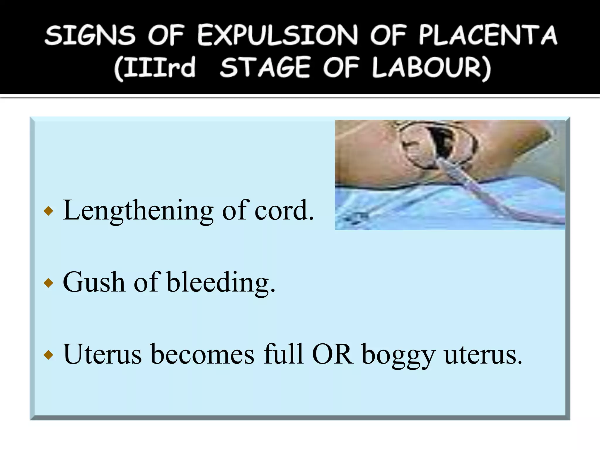 3rd stage OF LABOUR | PPTX