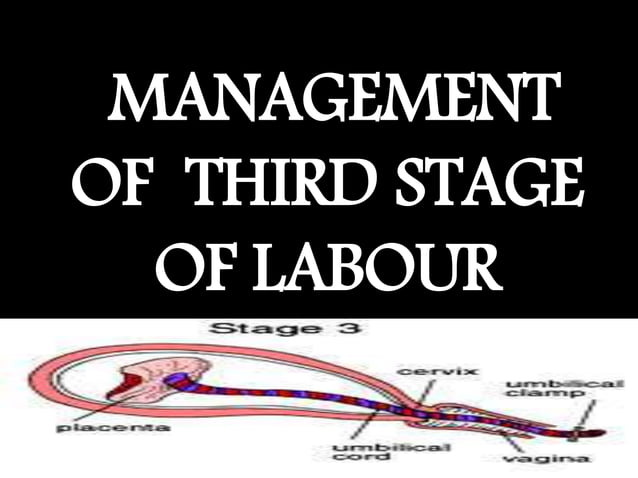 3rd stage OF LABOUR | PPTX | Pregnancy | Reproductive Health