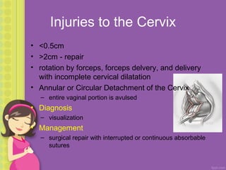 3rd stage of labor & abnormalities by liza tarca, md | PPT