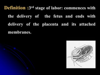 3rd stage of labour.ppt