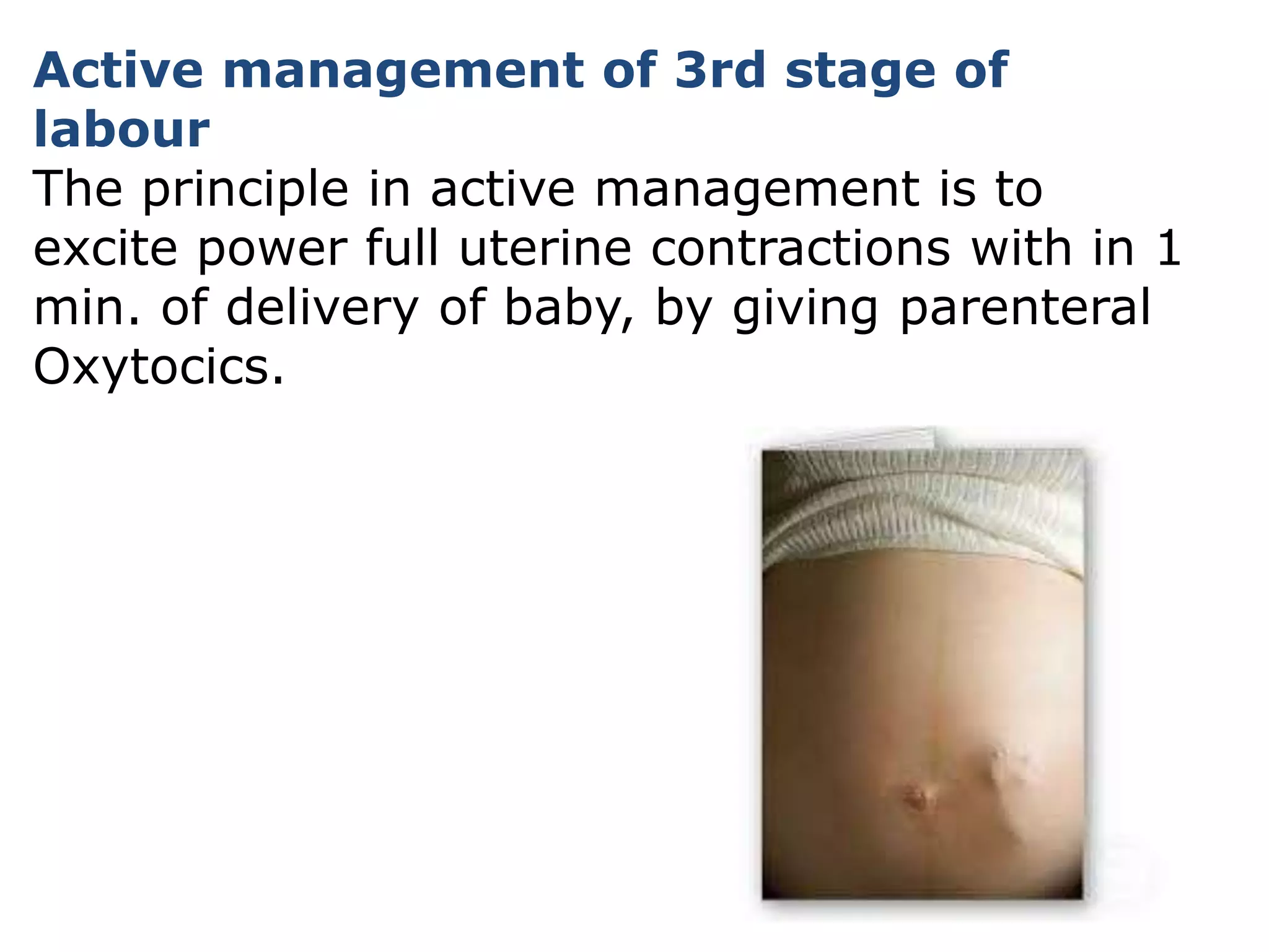 3rd stage of labour and its complications | PPTX