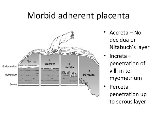 3rd stage of labour and its complications final