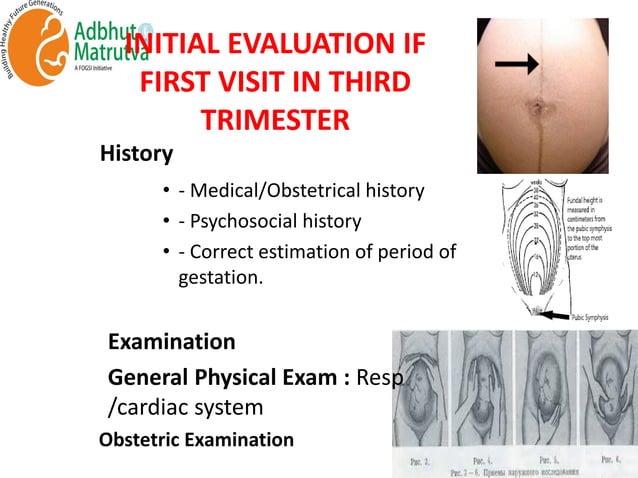 3rd trimester-Workup & Algorithms | PDF | Pregnancy | Reproductive Health
