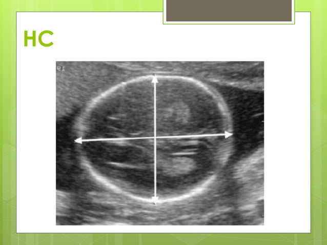 3rd trimester us | PPTX | Pregnancy | Reproductive Health