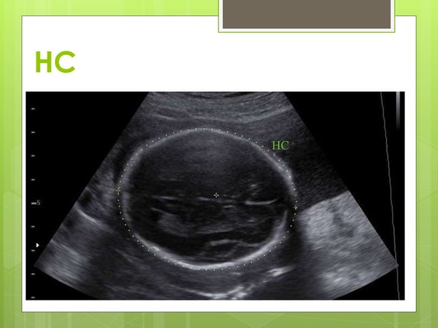 3rd trimester us | PPTX | Pregnancy | Reproductive Health