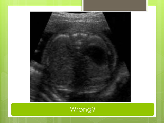 3rd trimester us | PPTX | Pregnancy | Reproductive Health