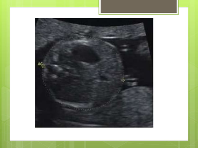 3rd trimester us | PPTX | Pregnancy | Reproductive Health
