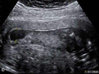 3rd trimester us | PPTX